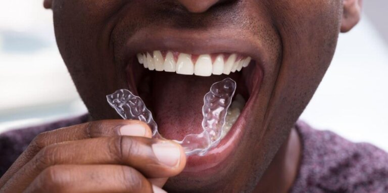 How To Use Invisalign Cleaning Crystals - Blossom Dental | York